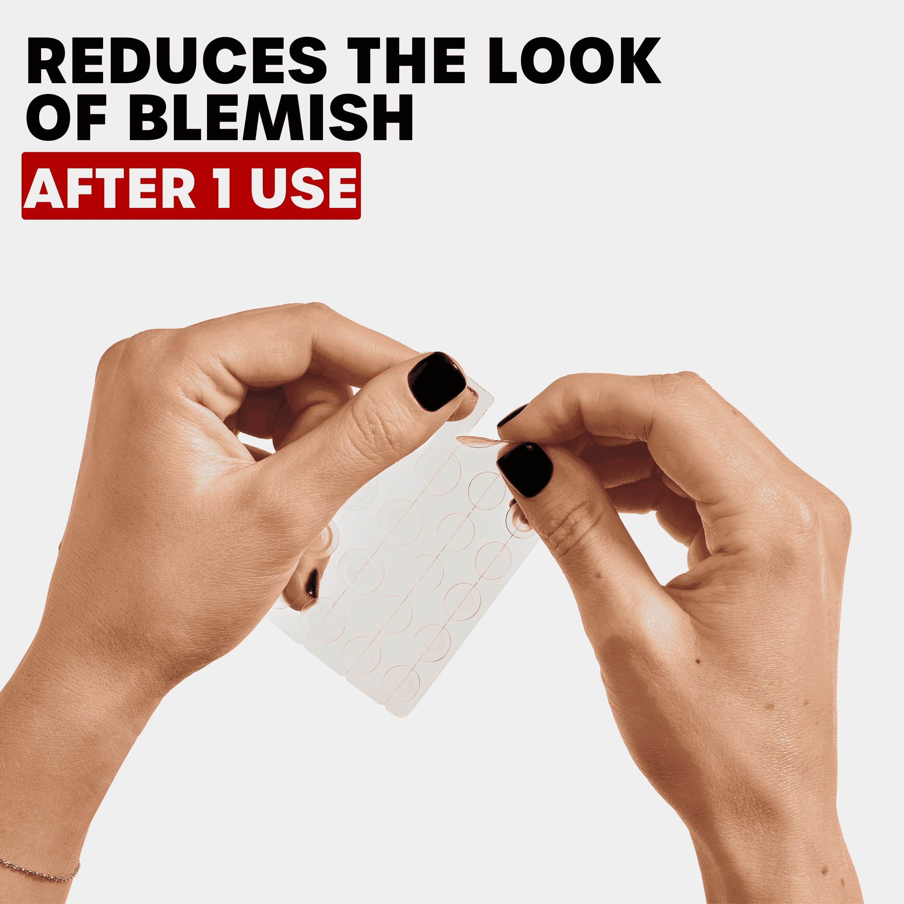 Invisible S.O.S Acne Patch with Hydrocolloid - Thayers