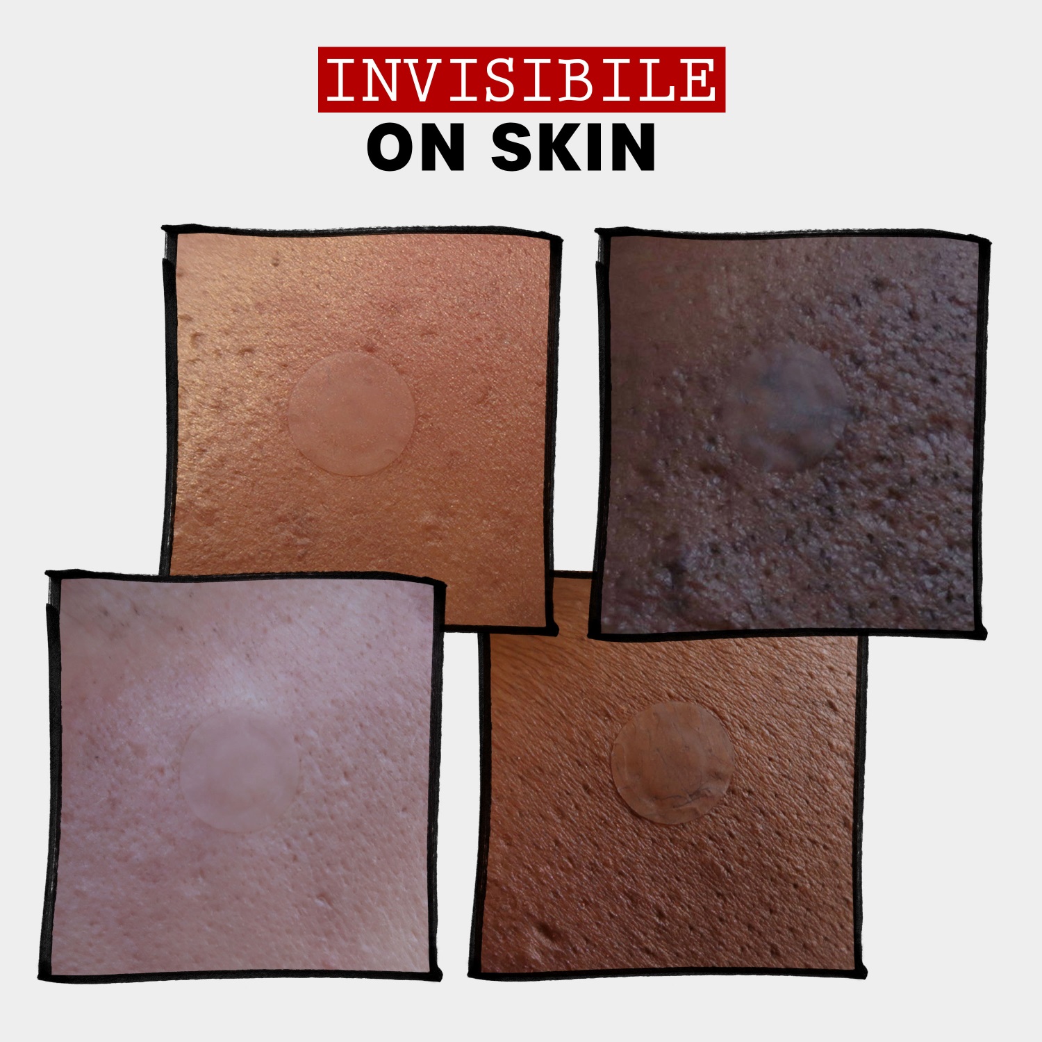 Invisible S.O.S Acne Patch with Hydrocolloid - Thayers