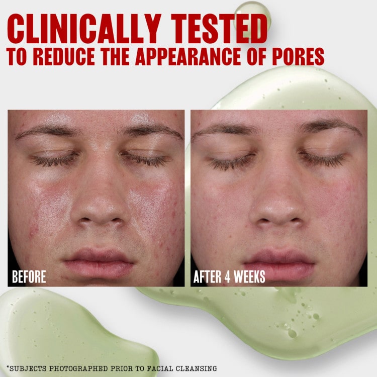 Oil Balancing Jelly Toner for Oily Skin & Shine - Thayers